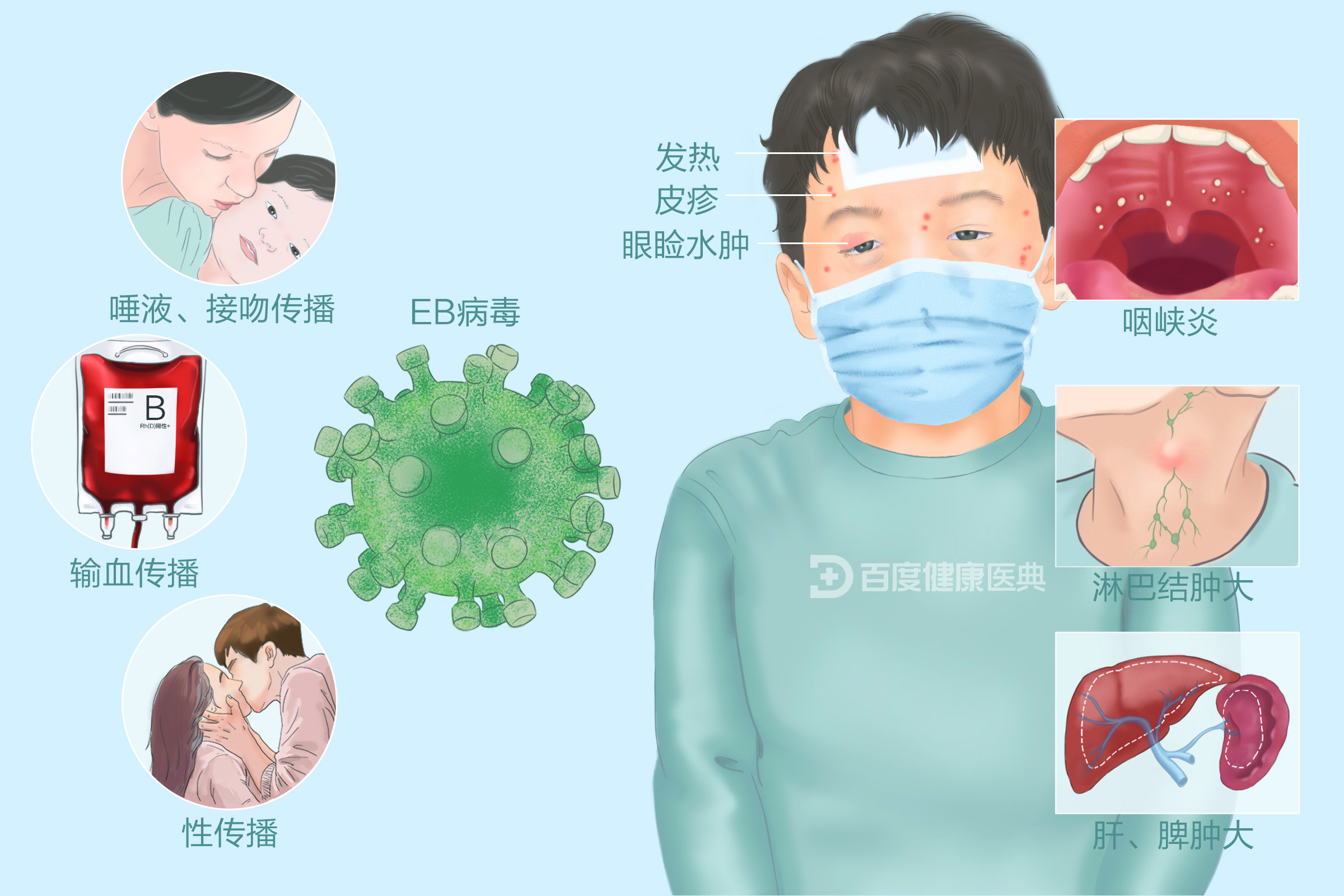 亲吻宝宝会感染EB病毒、曲靖市妇幼保健院